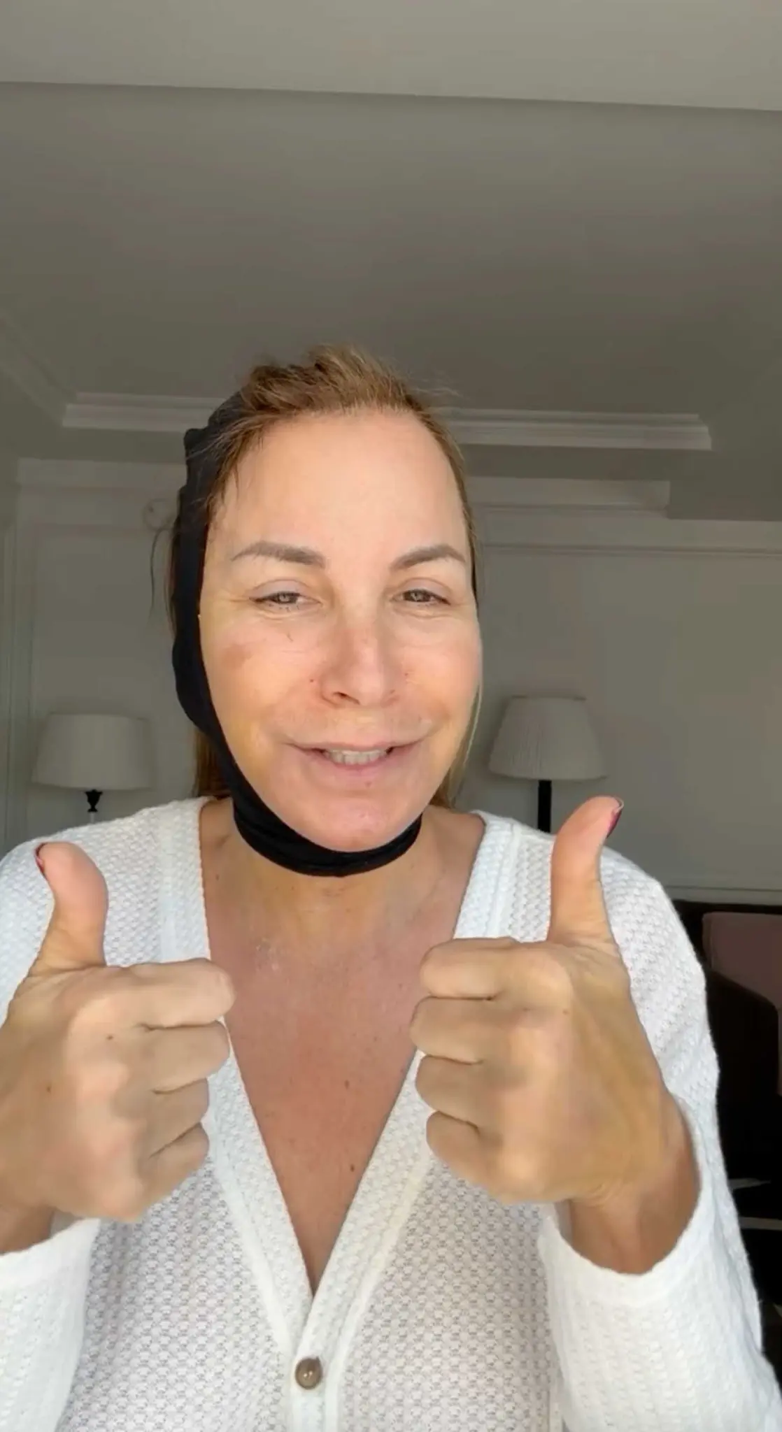 Jill Zarin Unveils Complete 'Facial Rejuvenation' — Here's the Full ...